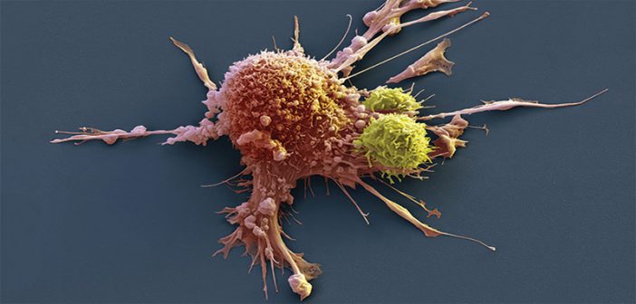 A suit of armour for cancer-fighting cells