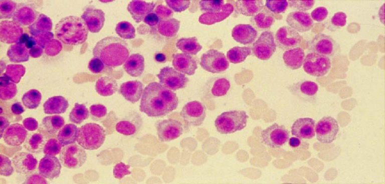 FDA grants accelerated approval to linvoseltamab-gcpt for relapsed or ...