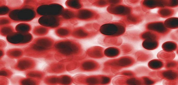 Small red blood cells could indicate cancer