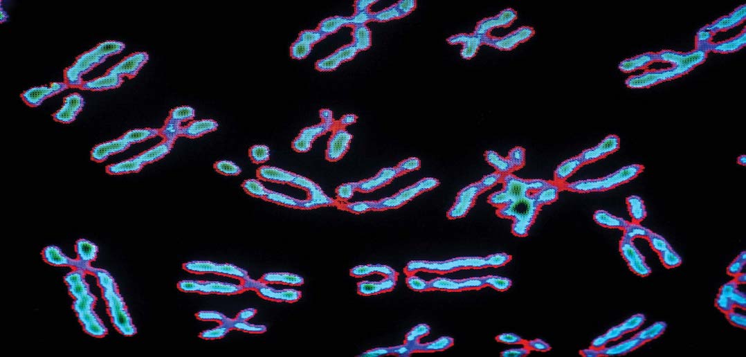 Ludwig Cancer Research study reveals even transient chromosomal errors ...