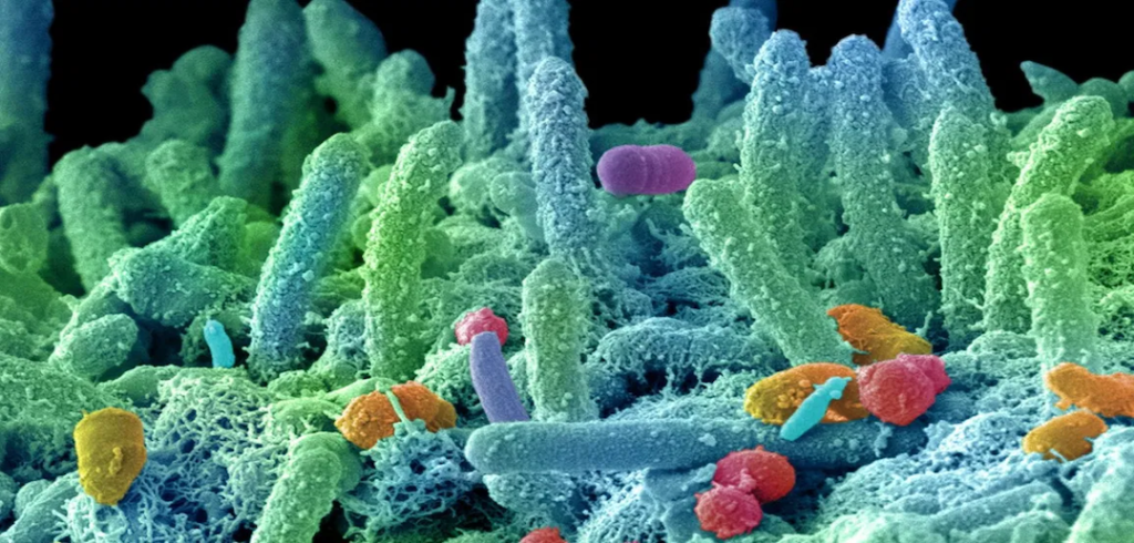 Personalised gut microbiome analysis for colorectal cancer ...