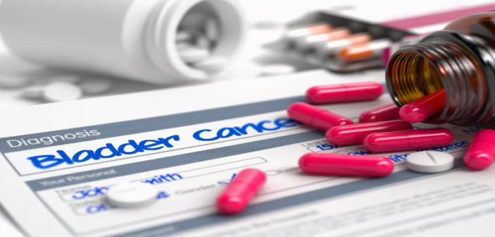 Therapeutically effective drugs identified for bladder cancer