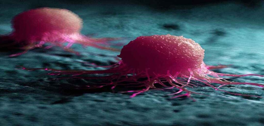 A nuclear target to revive anti-tumour immunity
