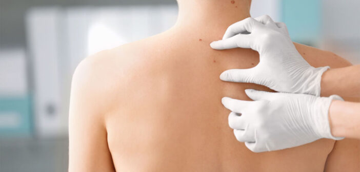 Handheld device could identify skin cancers painlessly