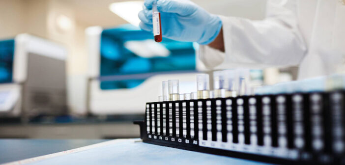 A noninvasive test to detect cancer cells and pinpoint their location