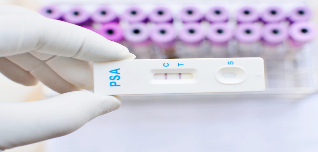 Screening with a PSA test has a small impact on prostate cancer deaths ...