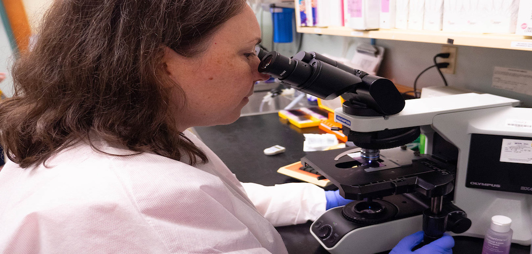 Palmitic acid promotes cancer metastasis and leaves a more aggressive ...