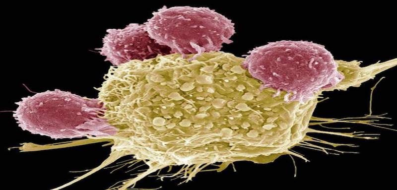 New immune cell “soldier” could be a good target for immunotherapy